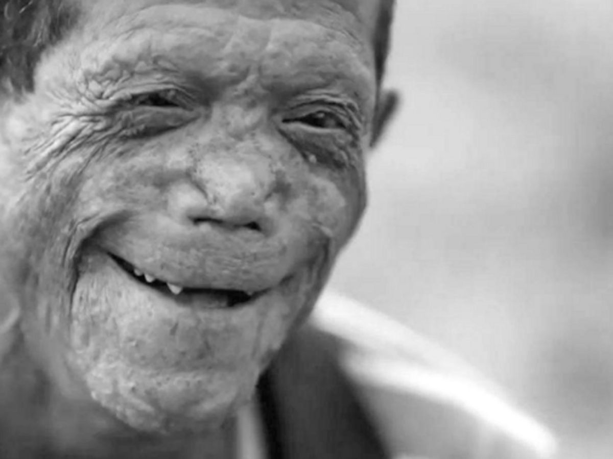 Why Patients In Egypt's Last Leprosy Colony Are Facing Eviction